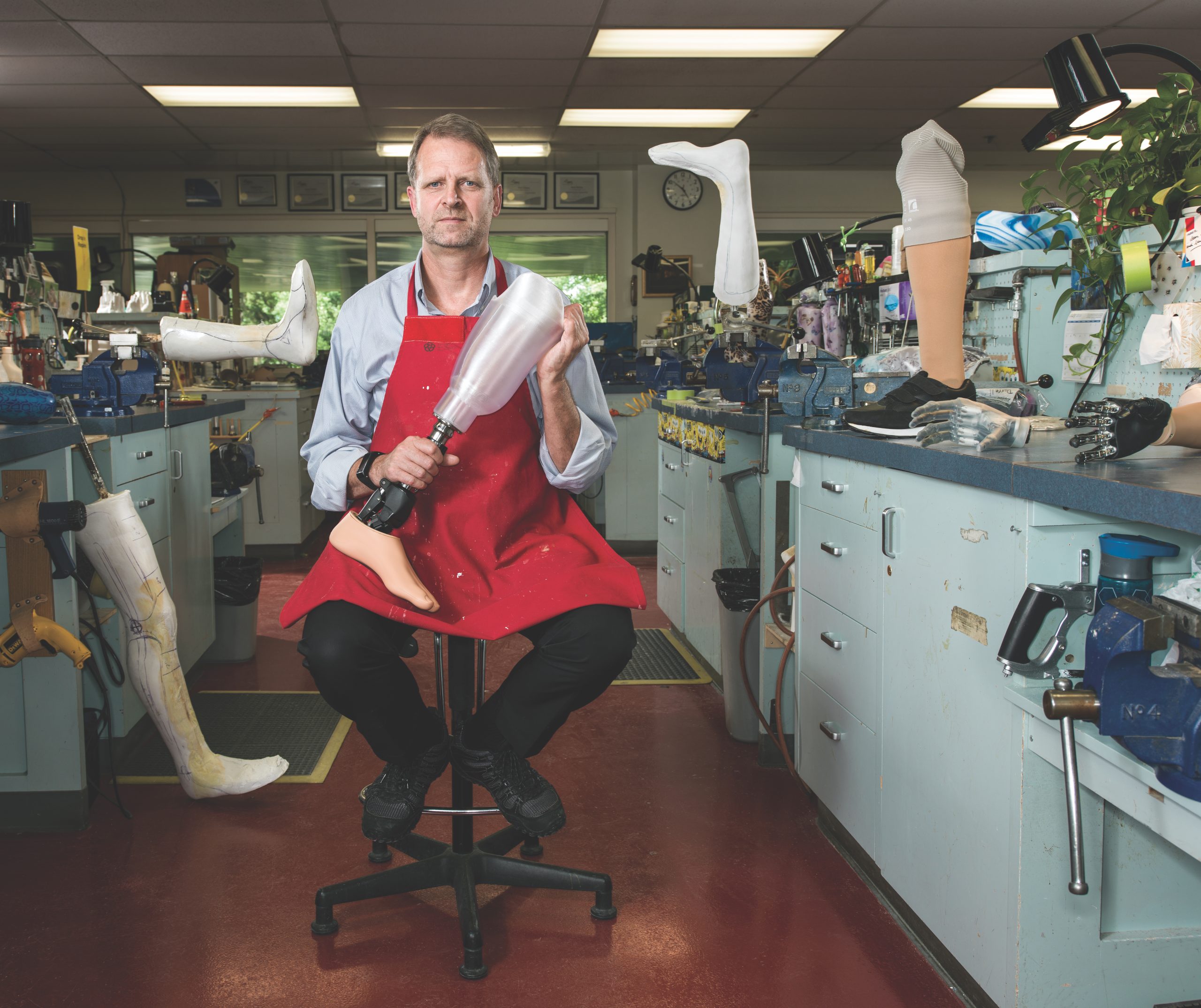 Expert: What I Know About… Prosthetics | Edify.